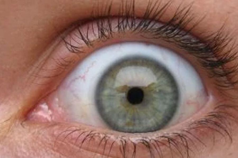 Ojo Binico Con Una Visin Ms Ntida Que El Ojo Humano Podra Estar