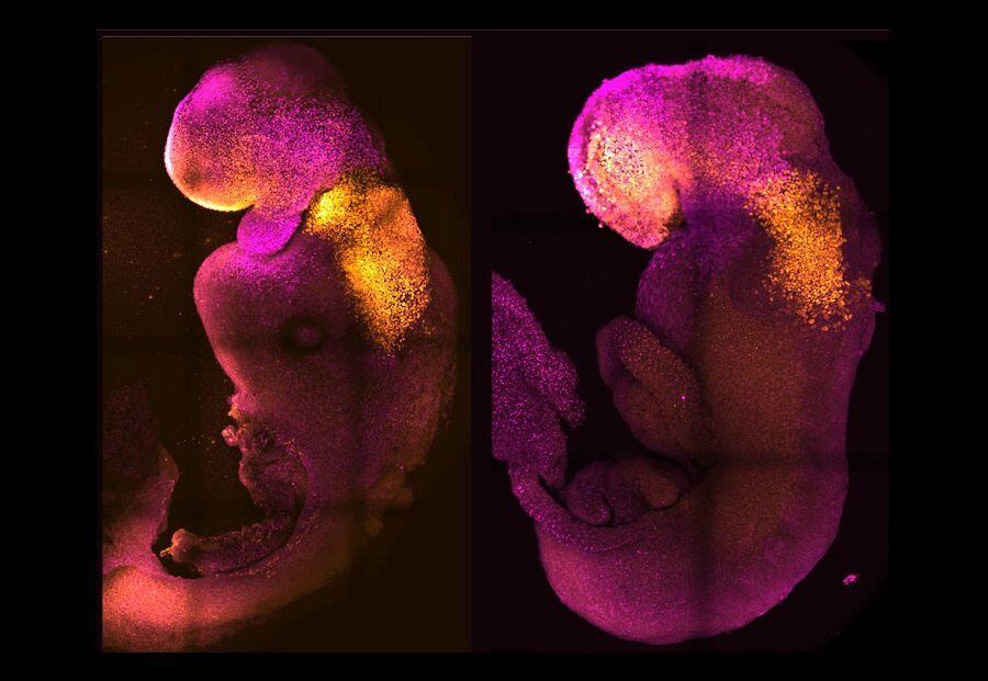 Científicos de Cambridge crean embriones sintéticos con cerebro y ...